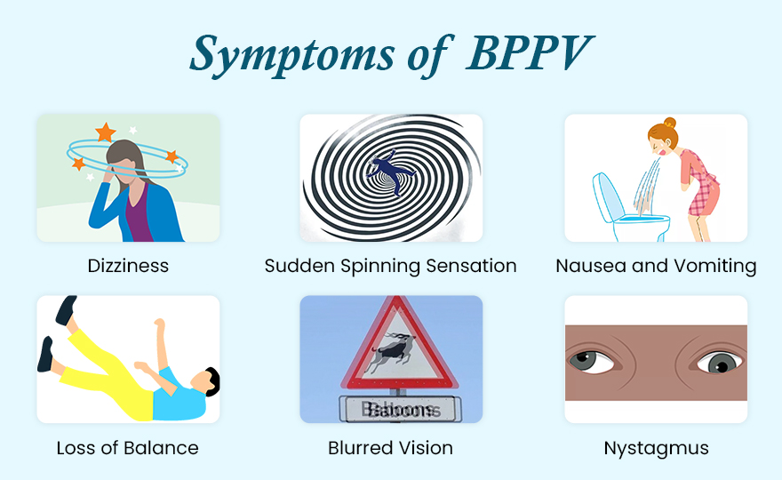 1 BPPV 1 BPPV
